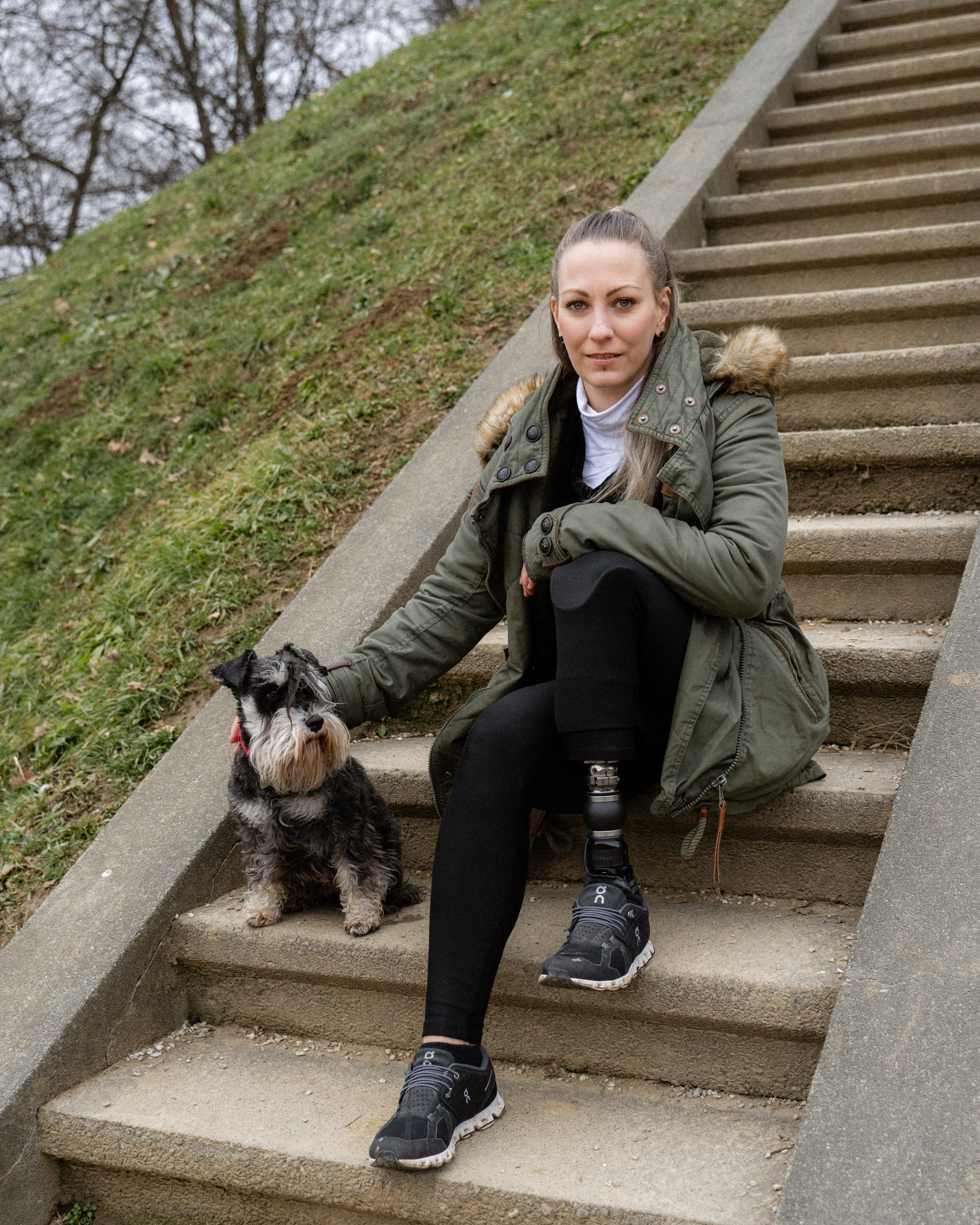 Maja Drobnjaković o životu bez jedne potkoljenice | Super1.hr