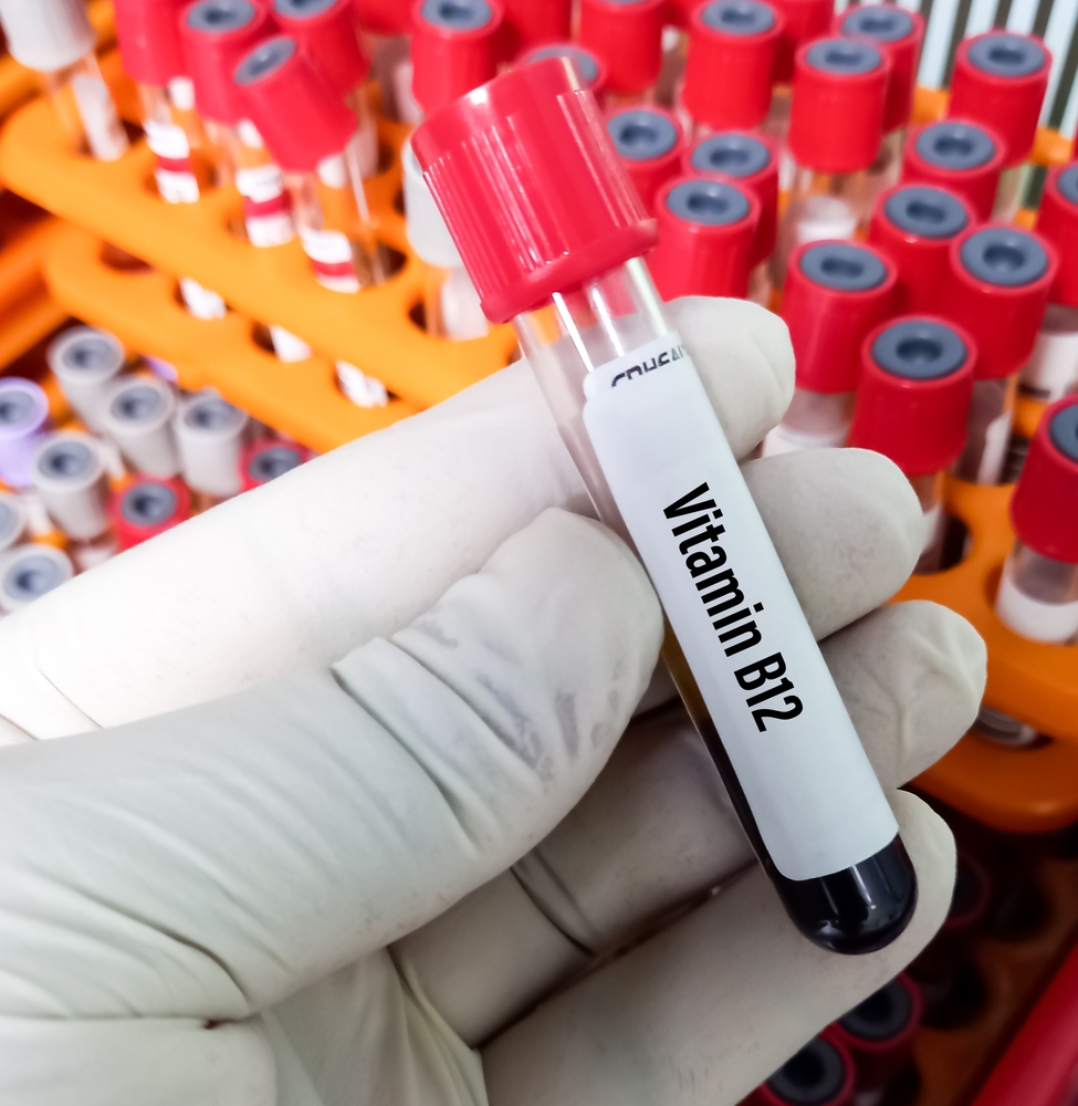 Bolesti povezane s nedostatkom vitamina B12: Kako ih prepoznati ...