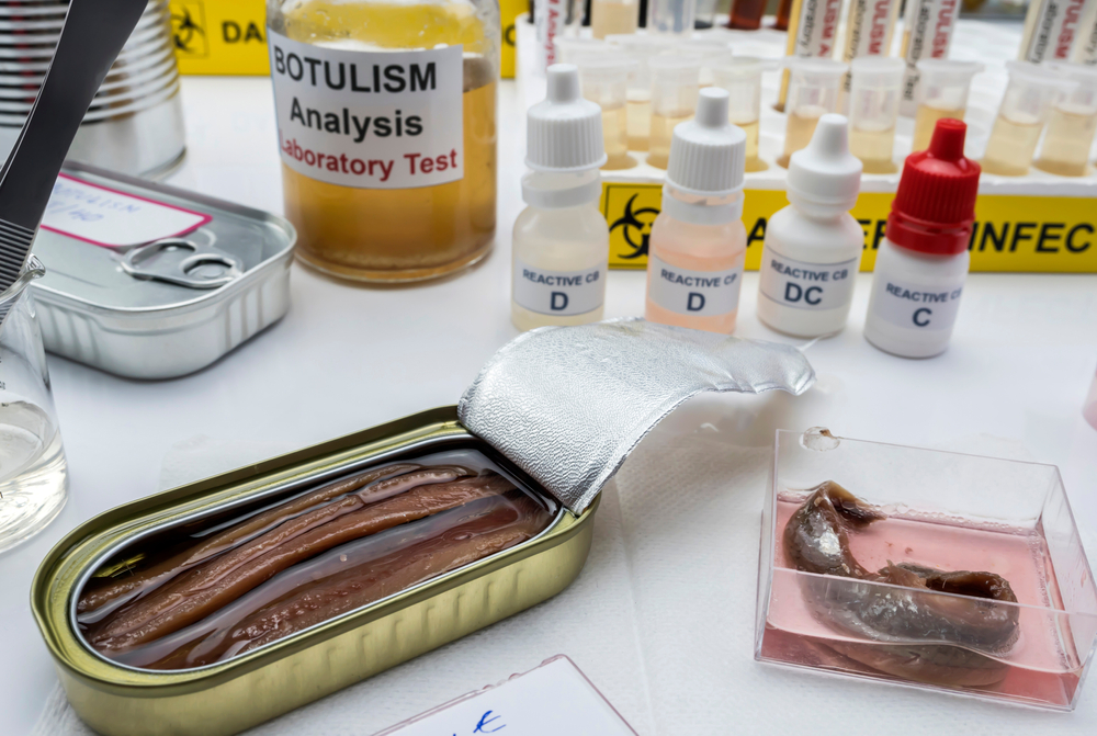 Botulizam: Simptomi, uzroci i liječenje bolesti opasne po život ...